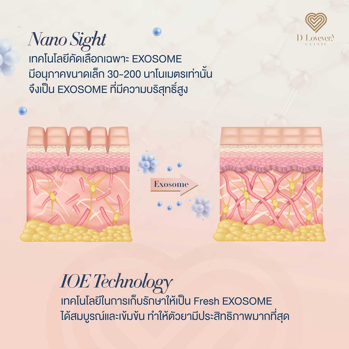 Exosome คืออะไร ดีไหม ราคาเท่าไหร่ - D’ Lovevery Clinic